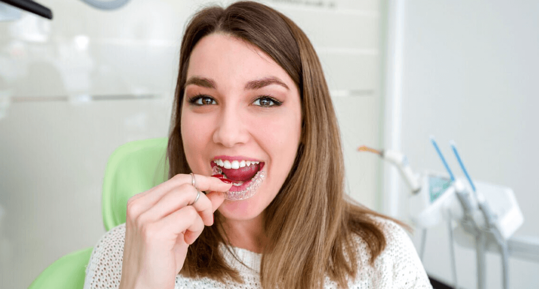 The Surprising Benefits of Invisalign for Jaw Alignment - nebadonia
